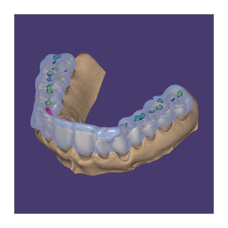 DentalCAD Flex-Lizenz Bite Splint Module, 460,00