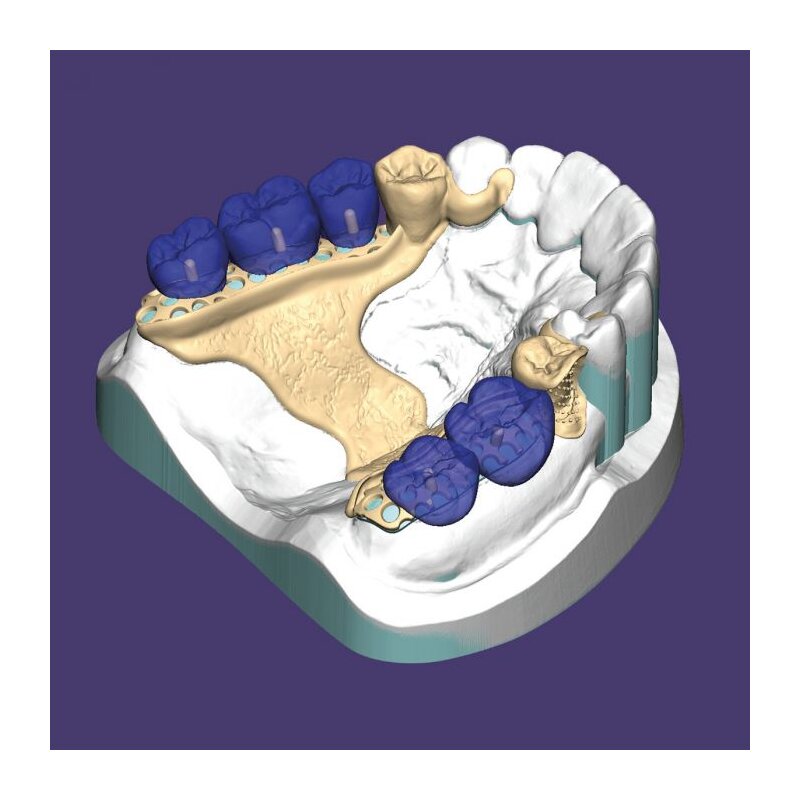 DentalDB Flex-License PartialCAD Module, 750,00